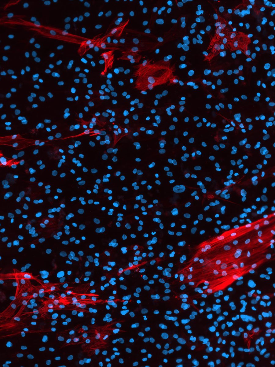 Primary Human Skeletal Muscle-Derived Cells & Media | Cook Myosite